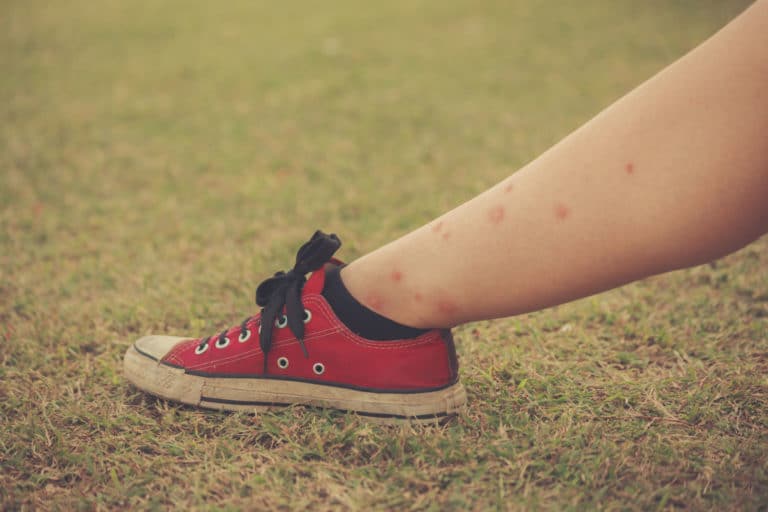 Bites and Stings - The Ultimate Guide to what Bit Me?